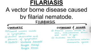 Filariasis.pptx