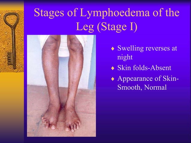 Lecture FIVE -Filariasis Pathogenesis.ppt