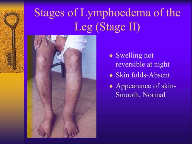 Lecture FIVE -Filariasis Pathogenesis.ppt