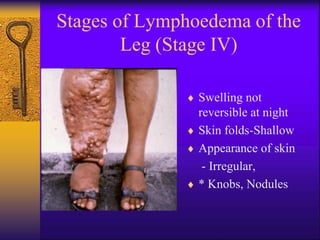 Lecture FIVE -Filariasis Pathogenesis.ppt