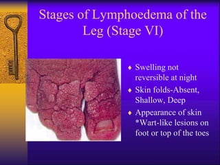 Lecture FIVE -Filariasis Pathogenesis.ppt
