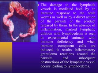 Lecture FIVE -Filariasis Pathogenesis.ppt