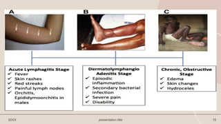 FILARIASIS Department of Physiotherapy, SHUATS | PPT