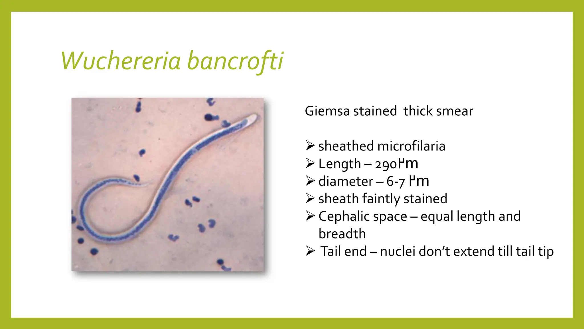 filariasis classification and general features | PPTX