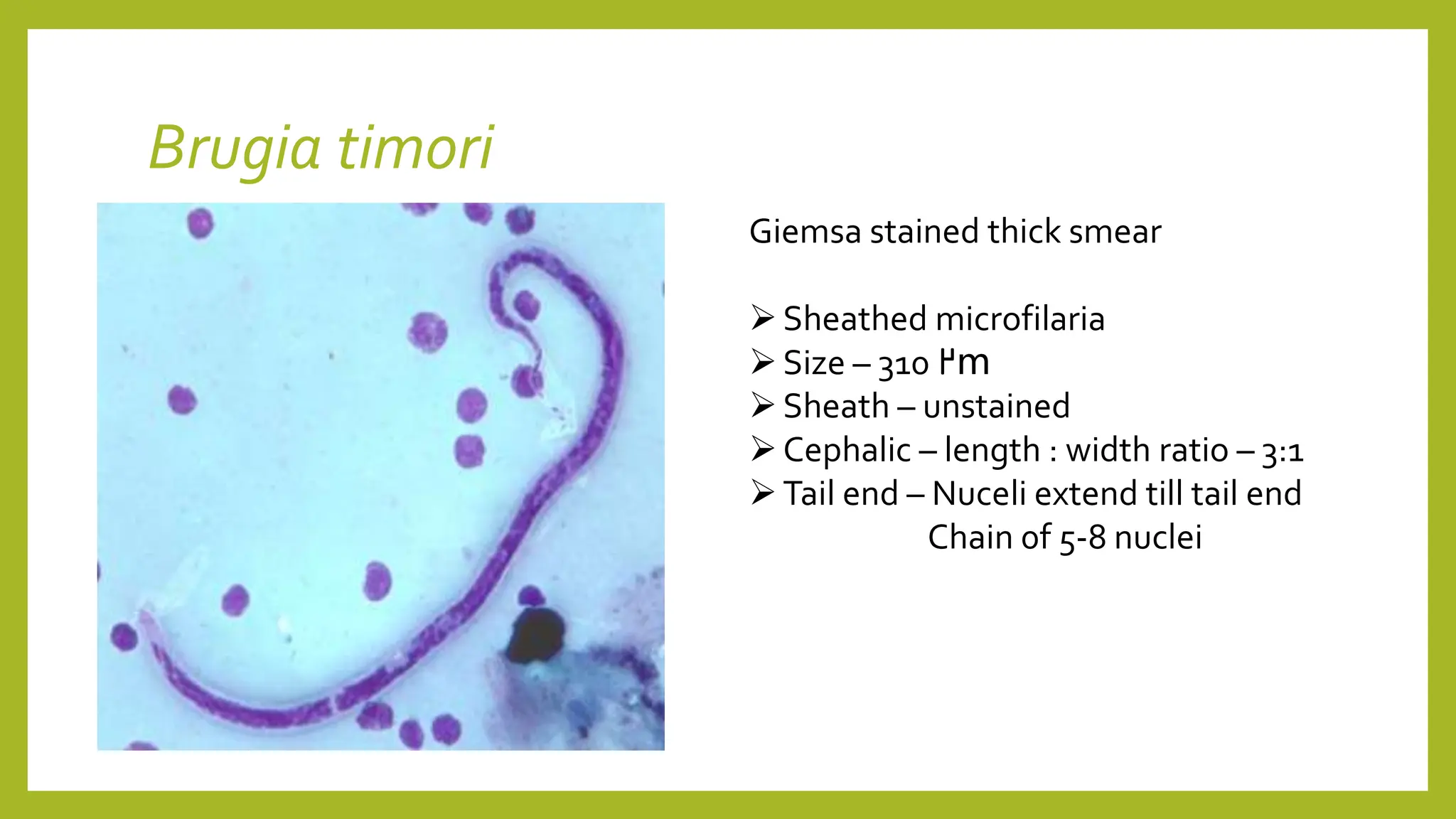filariasis classification and general features | PPTX