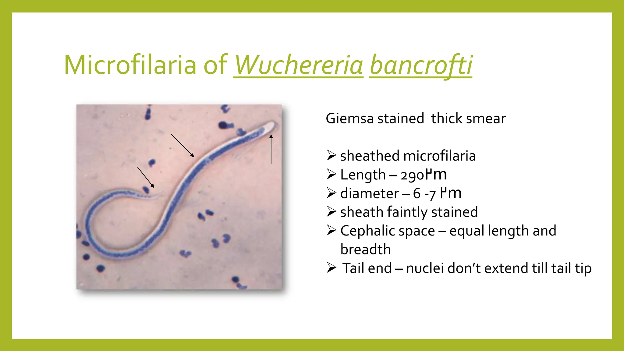 filariasis classification and general features | PPTX