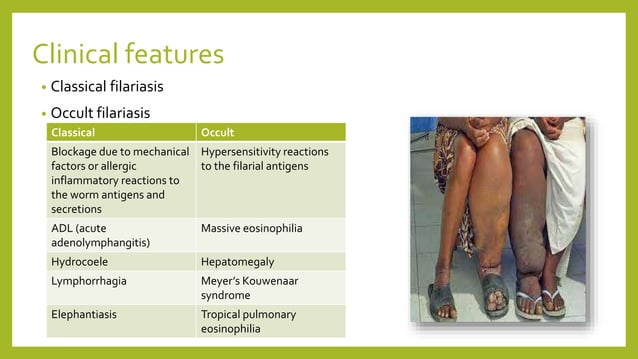 filariasis classification and general features | PPTX
