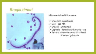 filariasis classification and general features | PPTX