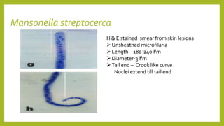 filariasis classification and general features | PPTX