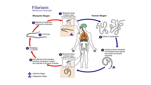 Filariasis I Lymphatic Filariasis I Community Medicine | PPTX ...