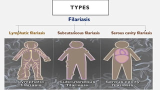 filariasis in Community Health Nursing...1.pptx