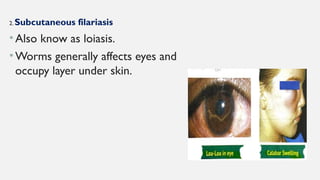 filariasis in Community Health Nursing...1.pptx