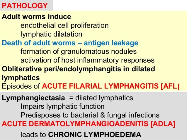 Filariasis clinical