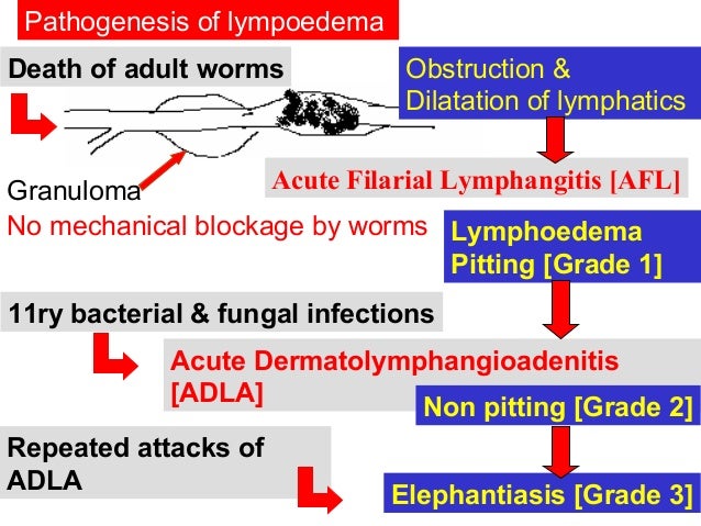 Filariasis clinical