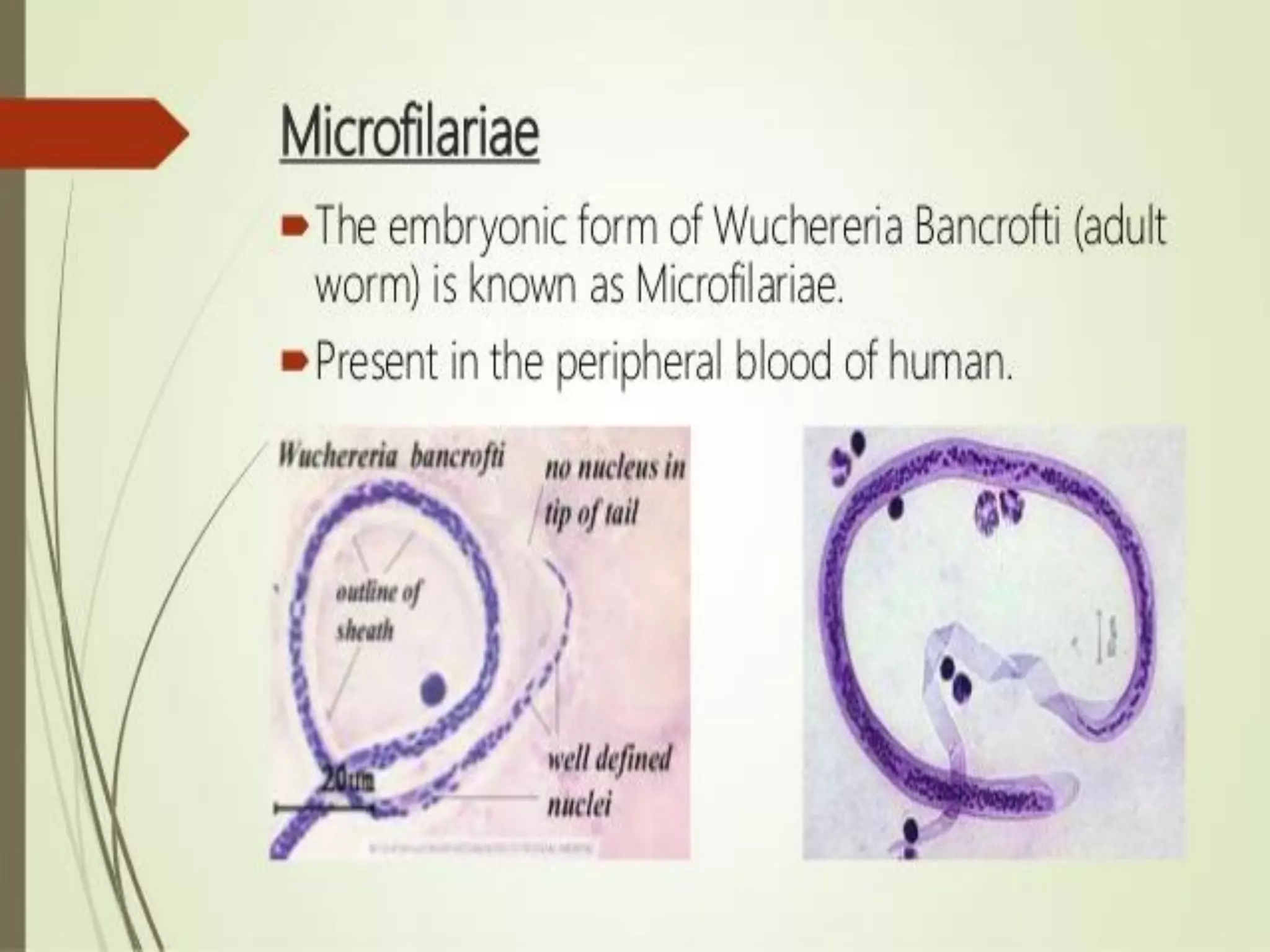 Lymphatic filariasis | PDF