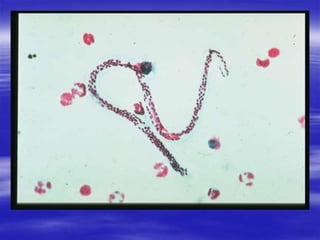 Filariasis1.ppt