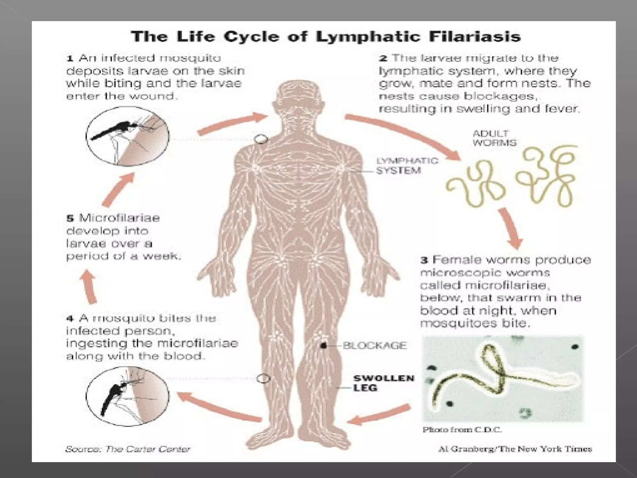 Filariasis | PPT