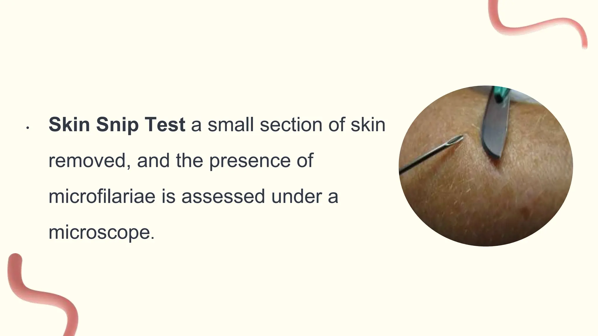 FILARIASIS CASE STUDY NURSING STUDENT.PPTX