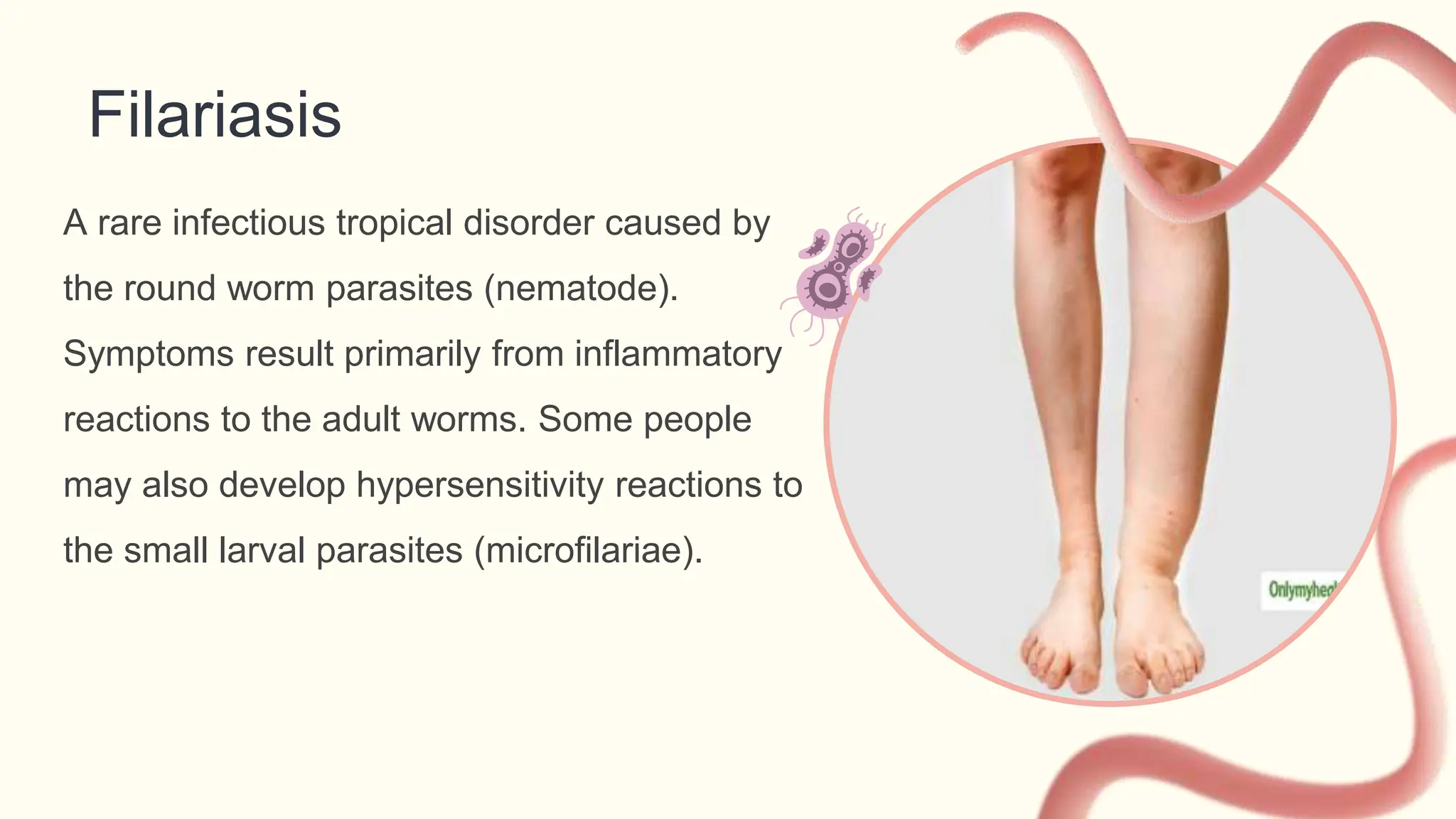 FILARIASIS CASE STUDY NURSING STUDENT.PPTX