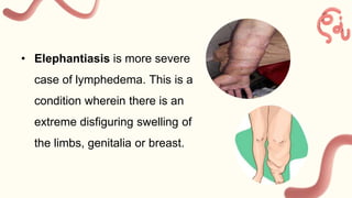 FILARIASIS CASE STUDY NURSING STUDENT.PPTX