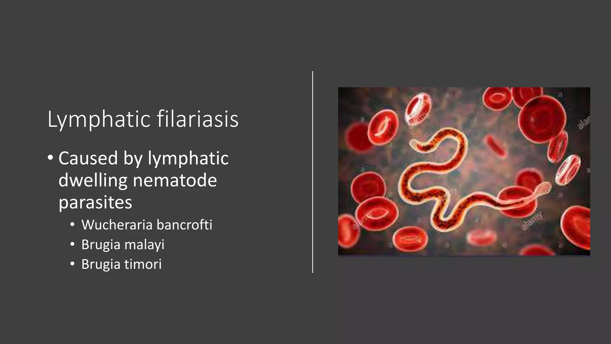 Filariasis | PPTX