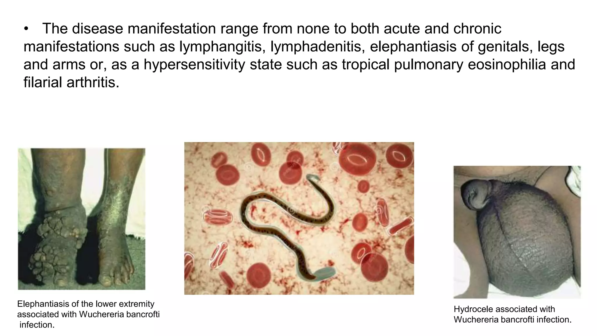 Community Medicine: Filariasis in Nepal | PPTX