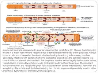 Lymphatic Filariasis jp | PPTX