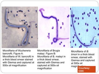 Brugia Malayi Microfilariae