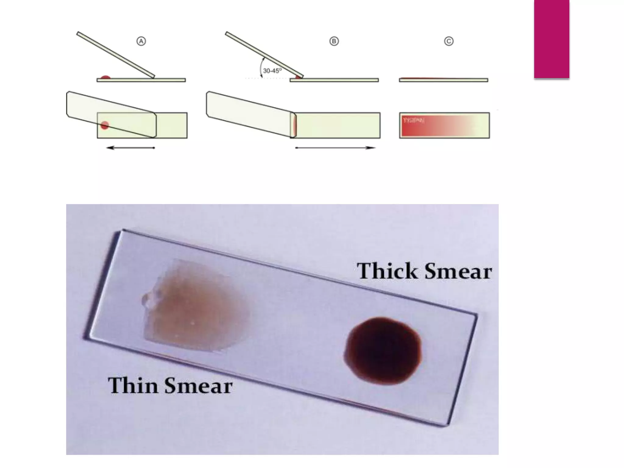 Filariasis laboratory diagnosis | PPTX