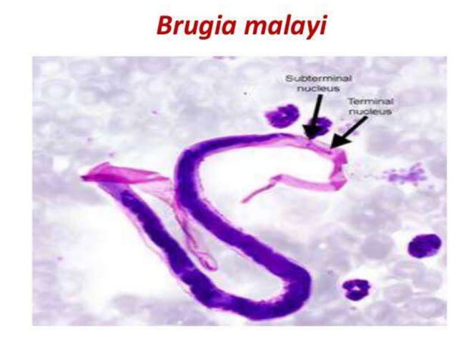 Filariasis laboratory diagnosis | PPTX