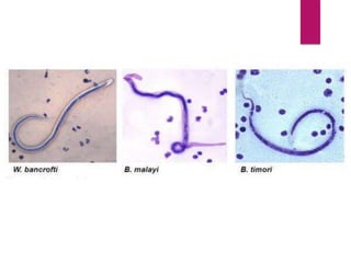 Filariasis laboratory diagnosis | PPTX