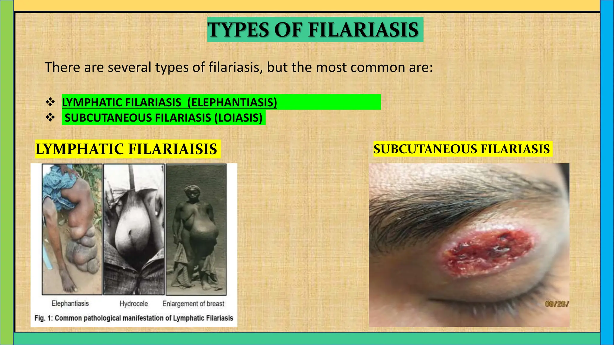 FILARIASIS (TRANSMISSION,TYPES,SYMPTOMS,PREVENTION,MCQS).pptx