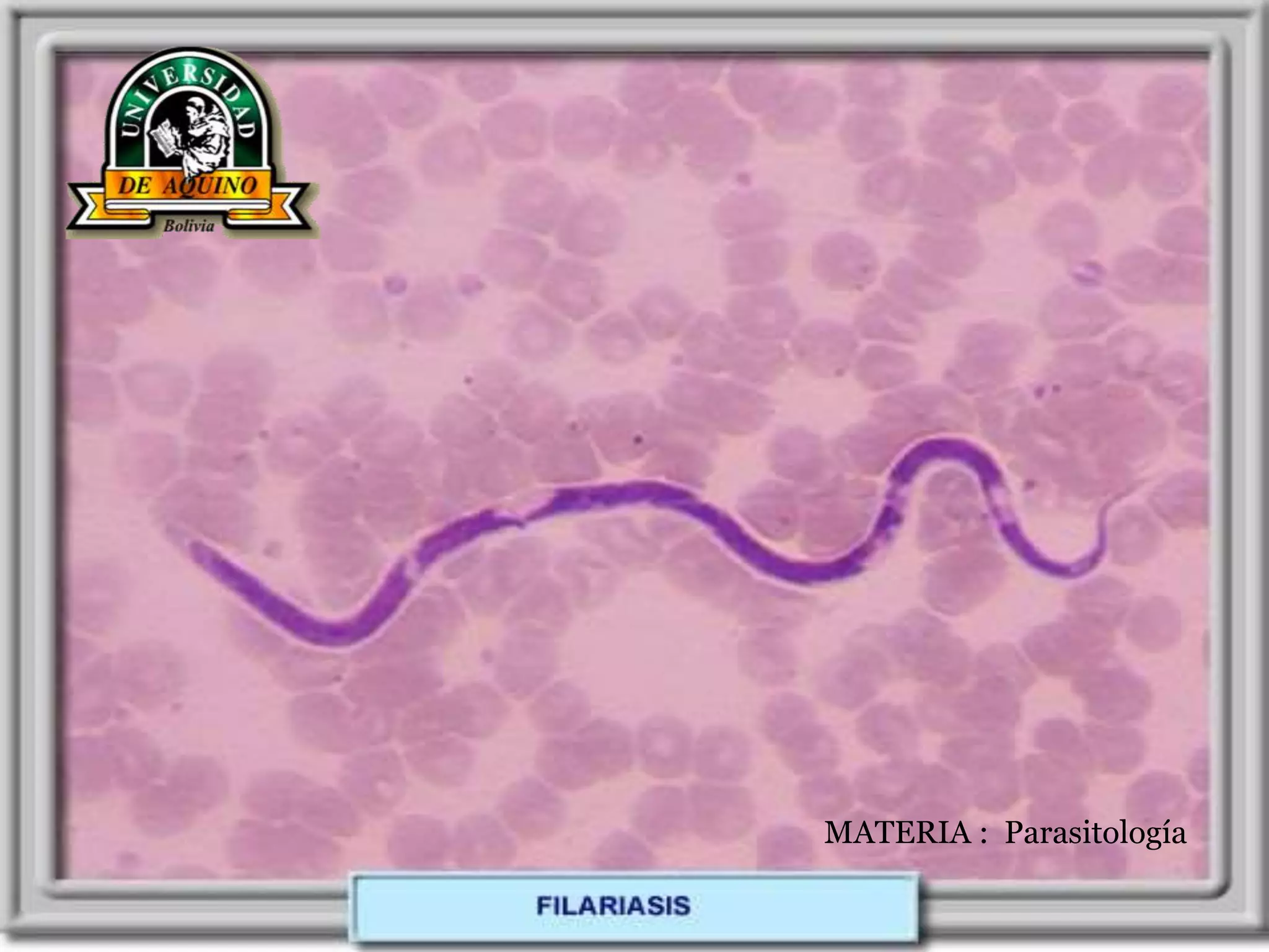 Filariasis y oncocercosis | PPTX