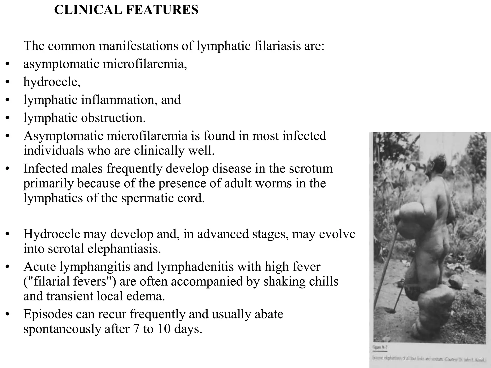 Filariioses 10 | PPTX