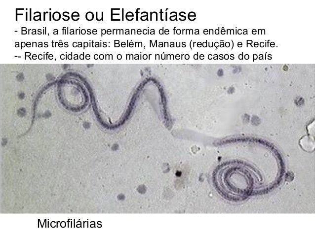 slide Filarioses