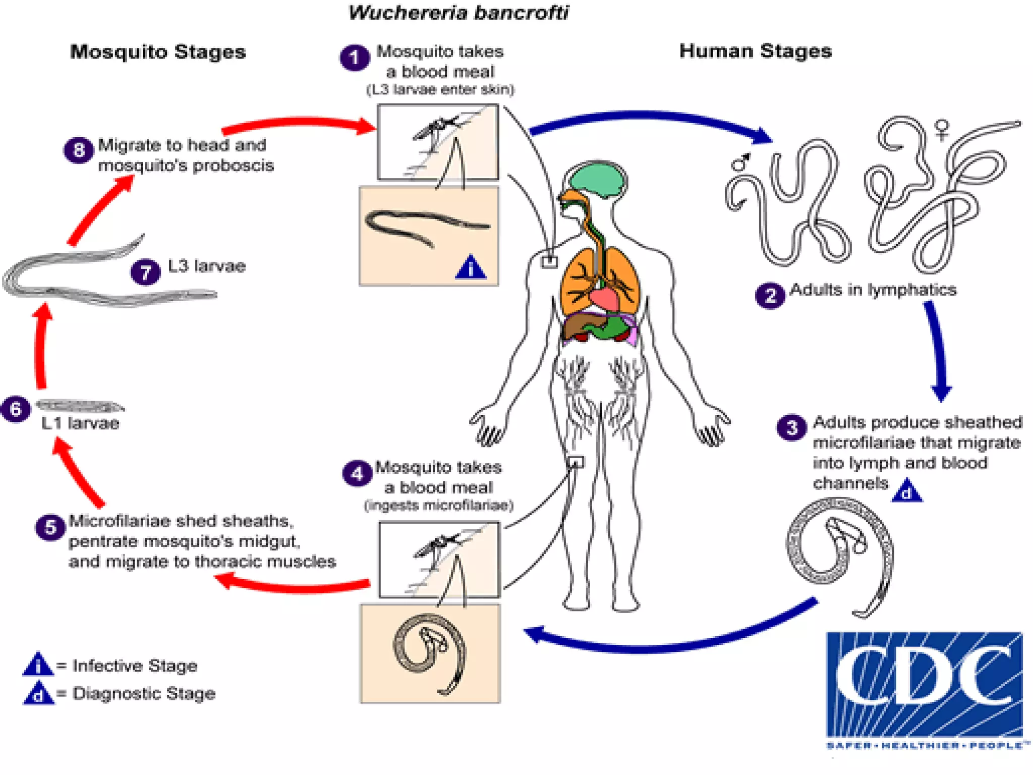 Filariasis | PPT