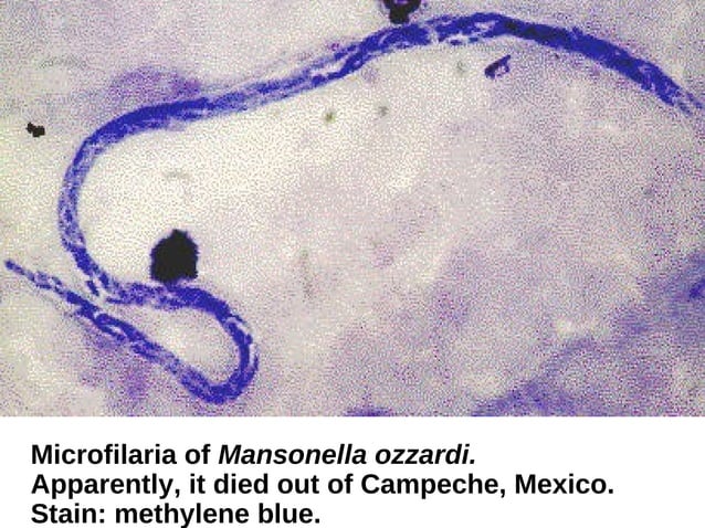 Filariasis | PPT | Infectious Diseases | Diseases and Conditions
