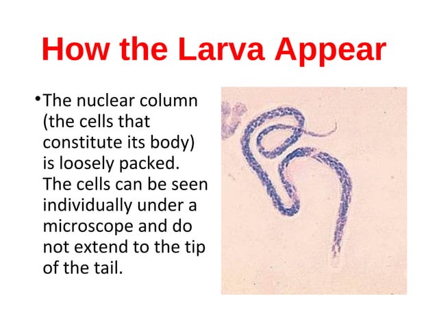 Filariasis | PPT | Infectious Diseases | Diseases and Conditions