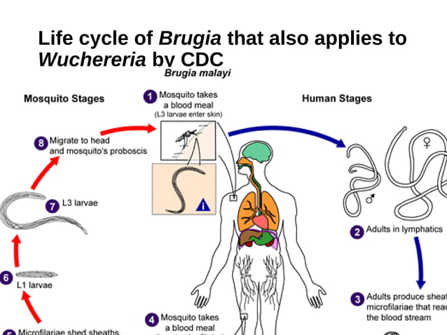 Filariasis | PPT | Infectious Diseases | Diseases and Conditions