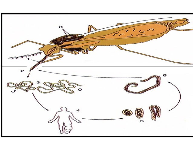 Filariasis | PPT | Infectious Diseases | Diseases and Conditions