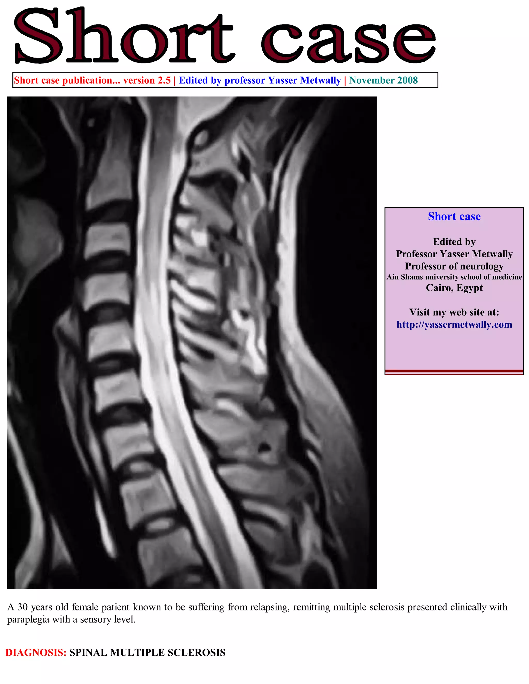 Short case...Spinal multiple sclerosis | PDF