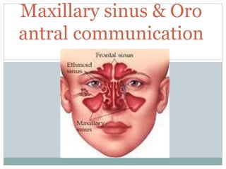 ORO ANTRAL COMMUNICATION(Dr.MANOJ KUMAR) | PPT