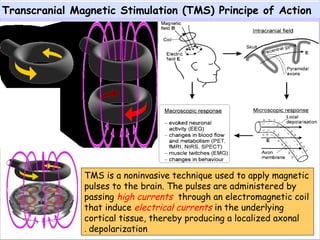 File2 | PPT | Brain and Nervous System Disorders | Diseases and Conditions