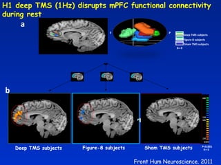 File2 | PPT | Brain and Nervous System Disorders | Diseases and Conditions