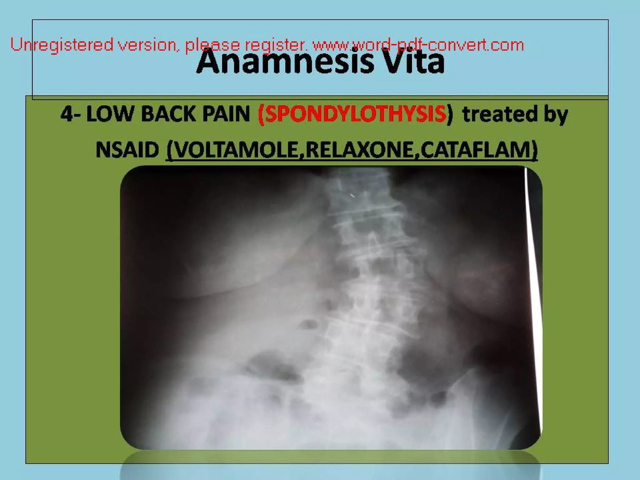 File2 high spinal anesthesia for cardiac high risk with spinal ...