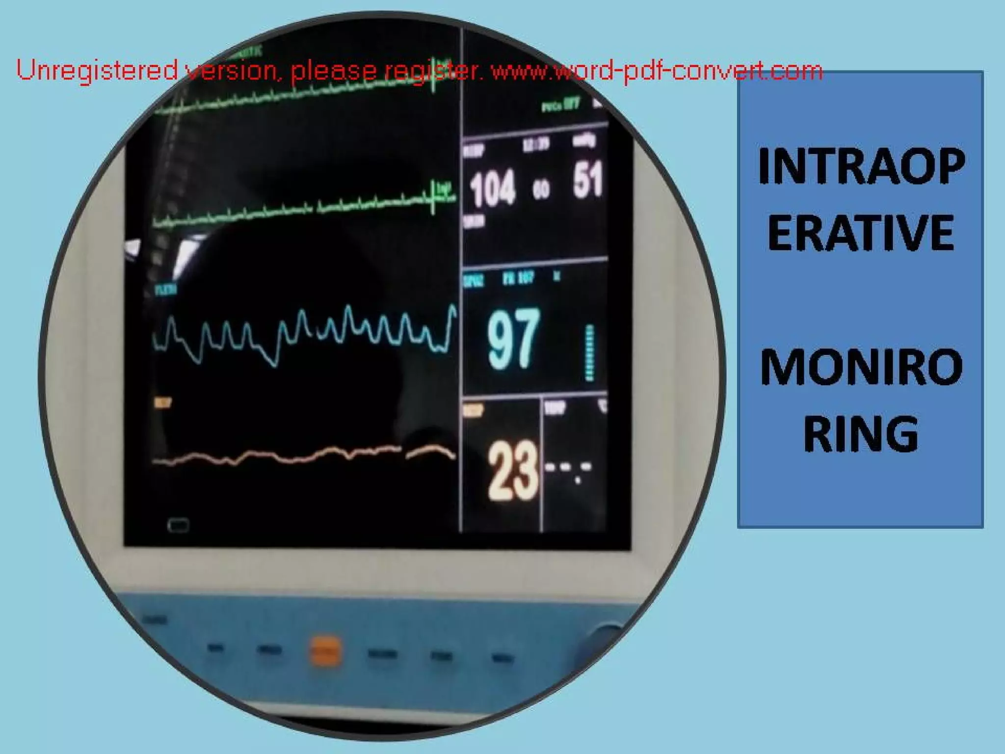 File2 high spinal anesthesia for cardiac high risk with spinal ...