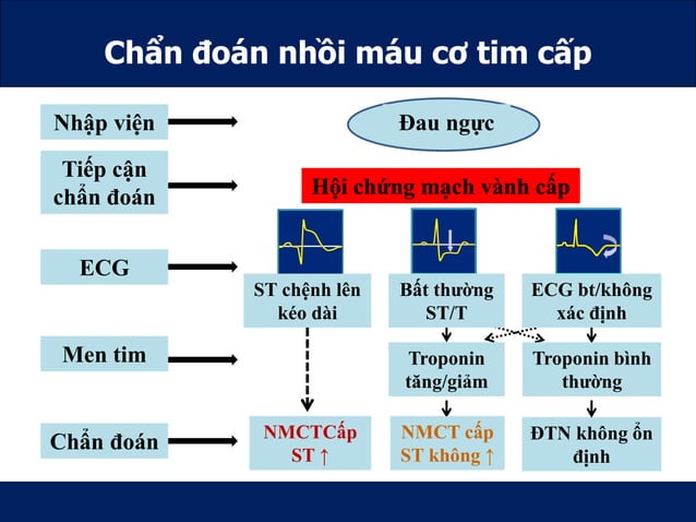 Chẩn đoán và điều trị NMCT | PDF