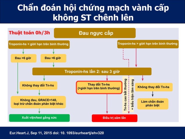 Chẩn đoán và điều trị NMCT | PDF