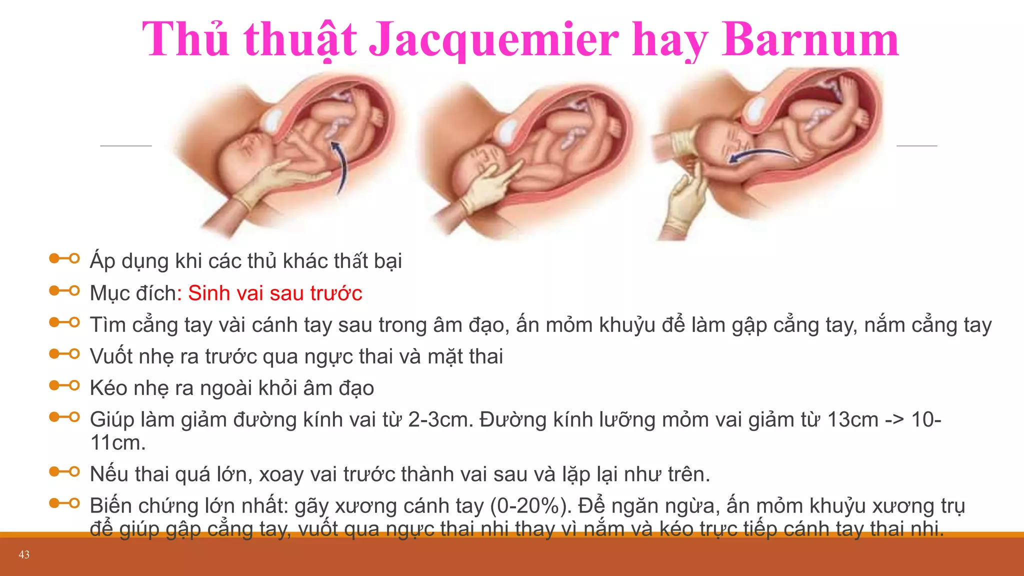 XỬ TRÍ CHUYỂN DẠ BẤT THƯỜNG | PPTX