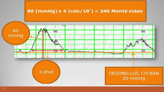 XỬ TRÍ CHUYỂN DẠ BẤT THƯỜNG | PPTX